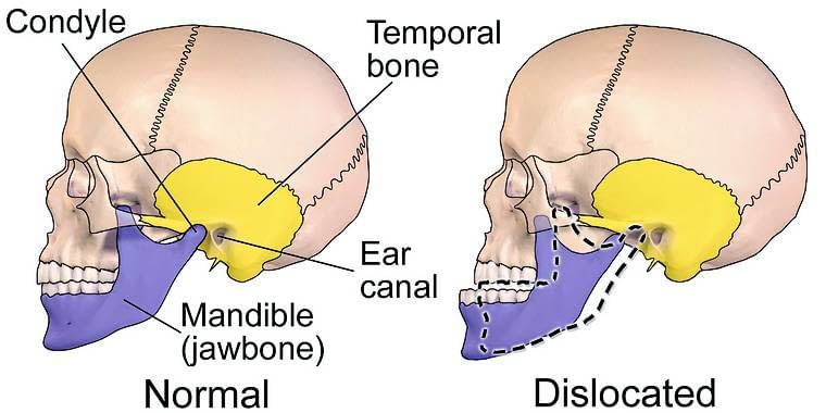 The Temporomandibular Joint (Temporomandibular Joints) - Harley Street ...